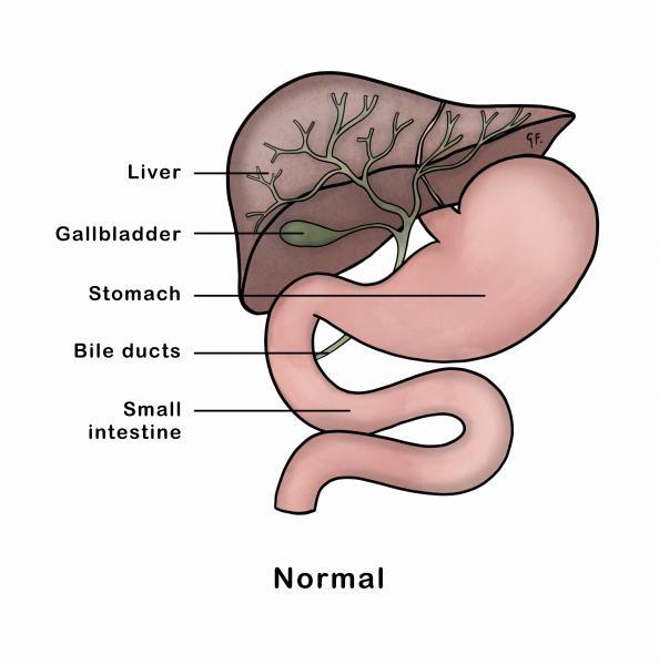 Biliary Atresia | KidsHealth New Zealand's Trusted Voice On Children's Health